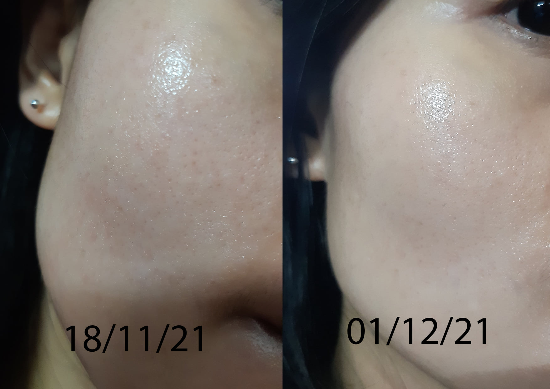 Review Discromia Control Serum thần dược cho làn da bị tăng sắc tố